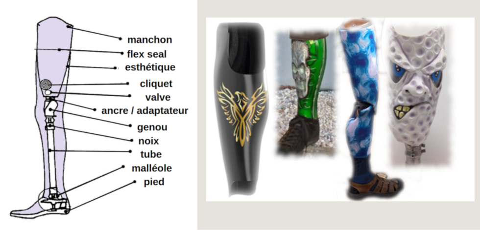 Prothèses de jambes après amputation tibiale ou fémorale